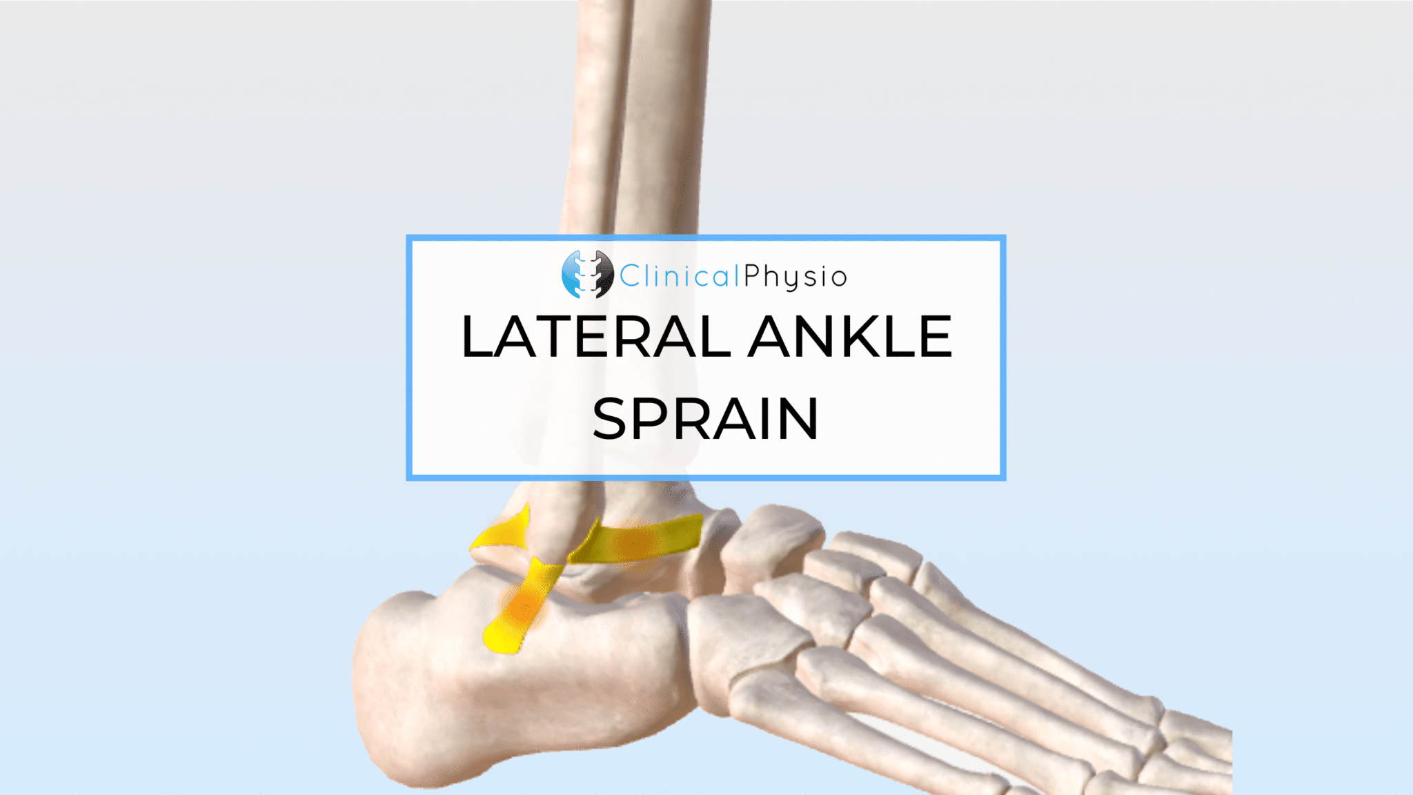 Lateral Ankle Sprain – Clinical Physio Membership