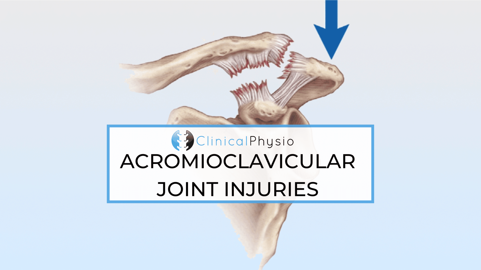 Acromioclavicular Joint Injuries – Clinical Physio Membership