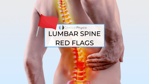 Overview of Common Spinal Red Flags in Lumbar Spine – Clinical Physio ...