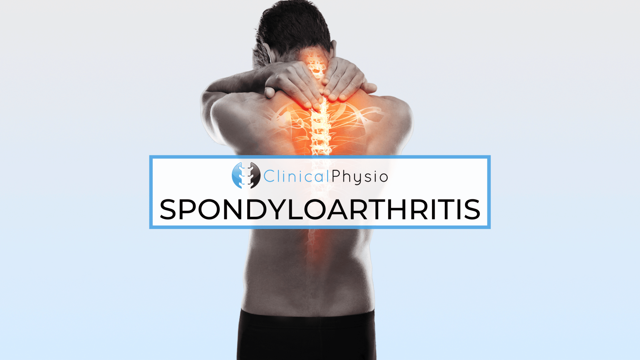 Axial and Peripheral Spondyloarthritis – Clinical Physio Membership