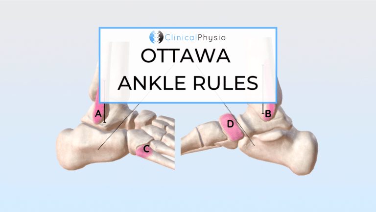 Ottawa Ankle Rules – Clinical Physio Membership