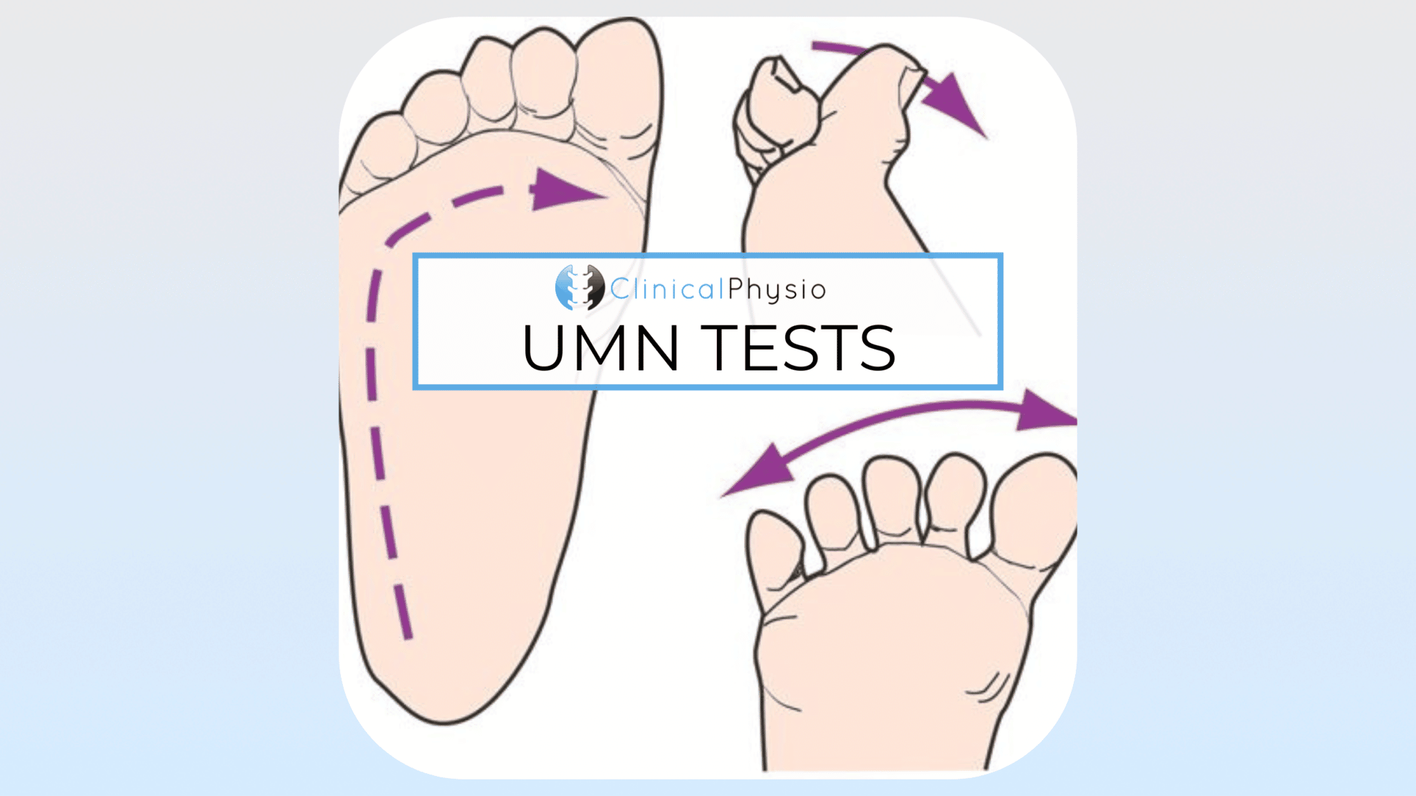 Inverted supinator sign – Clinical Physio Membership