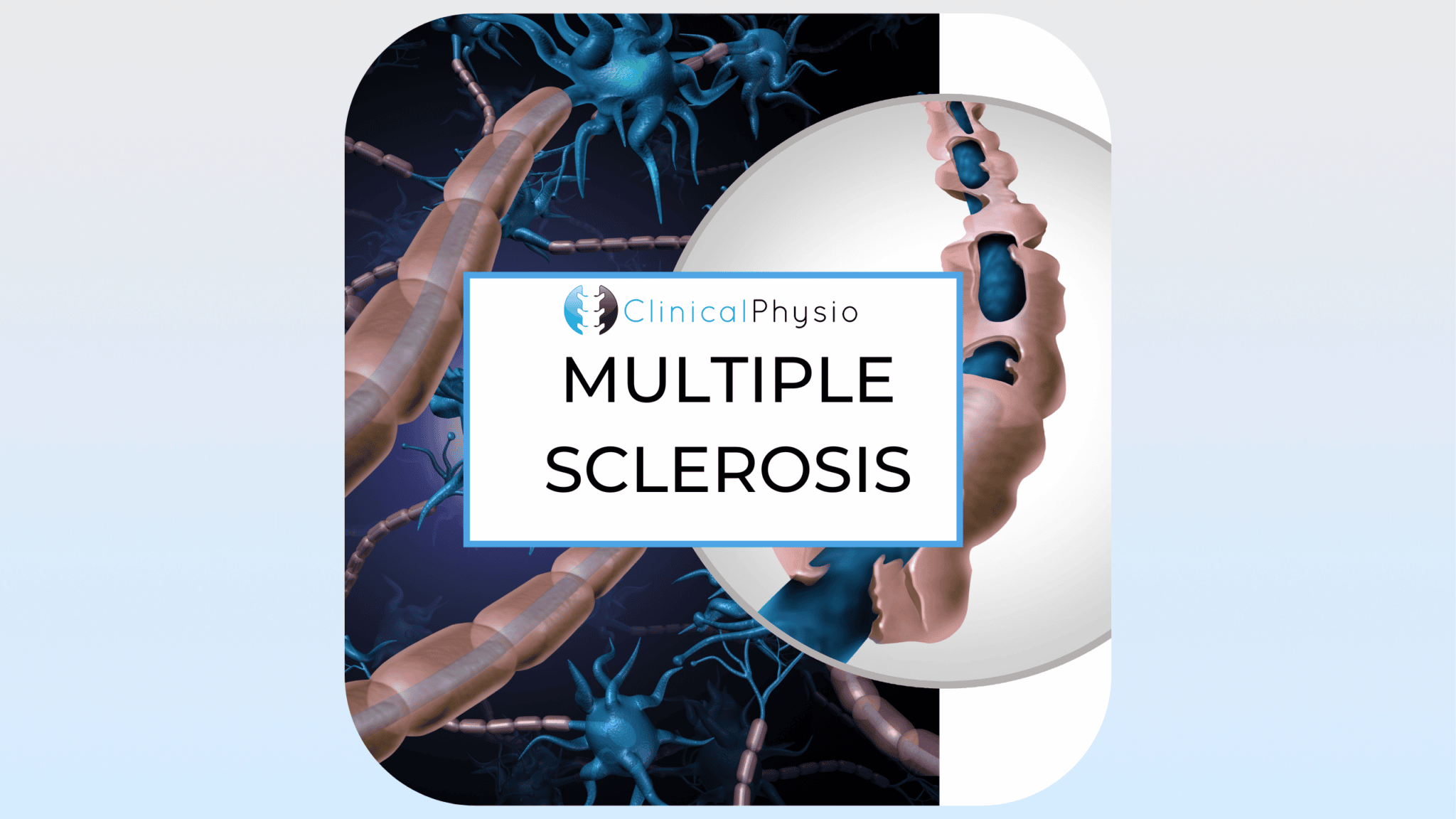 Multiple Sclerosis – Clinical Physio Membership