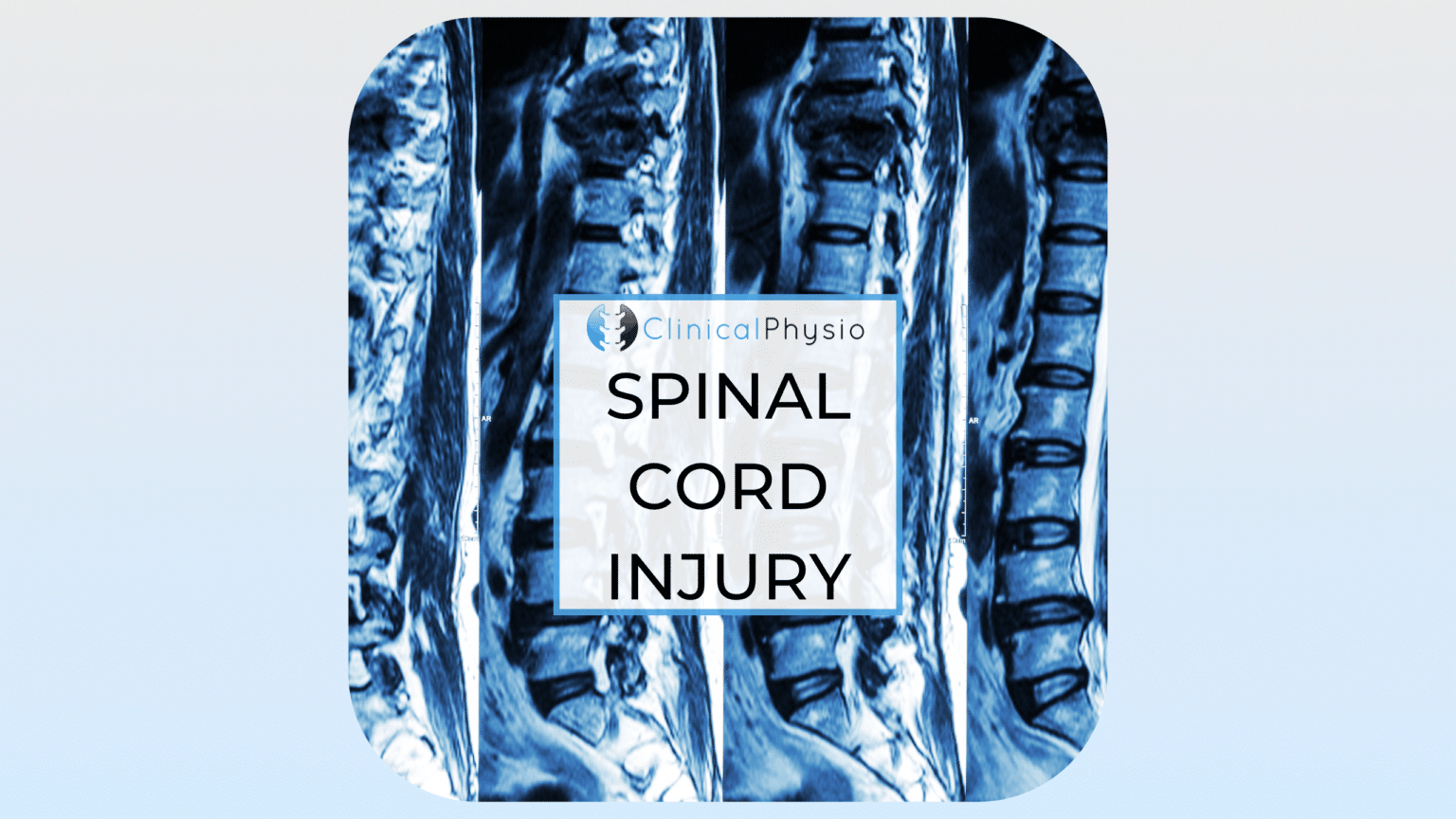 Spinal Cord Injury – Clinical Physio Membership