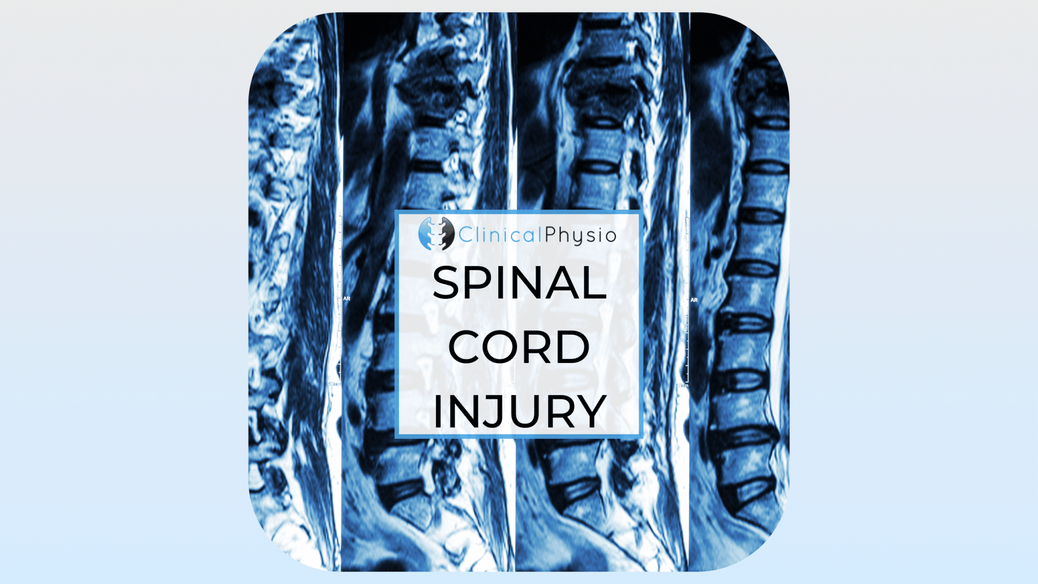 Spinal Cord Injury – Clinical Physio Membership