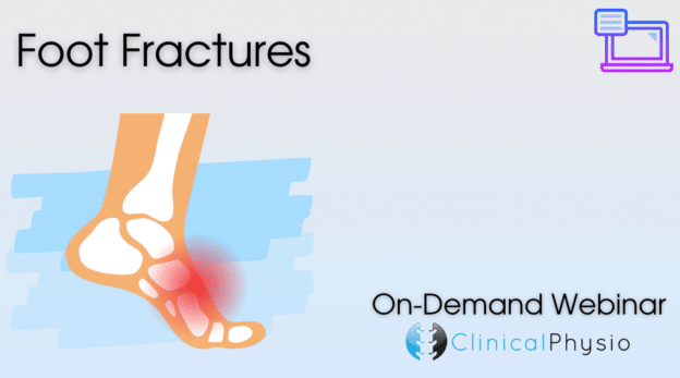 Foot Fractures – Clinical Physio Membership