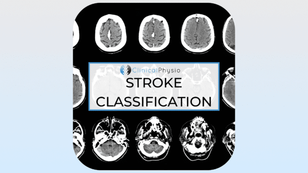 Stroke Classification – Clinical Physio Membership