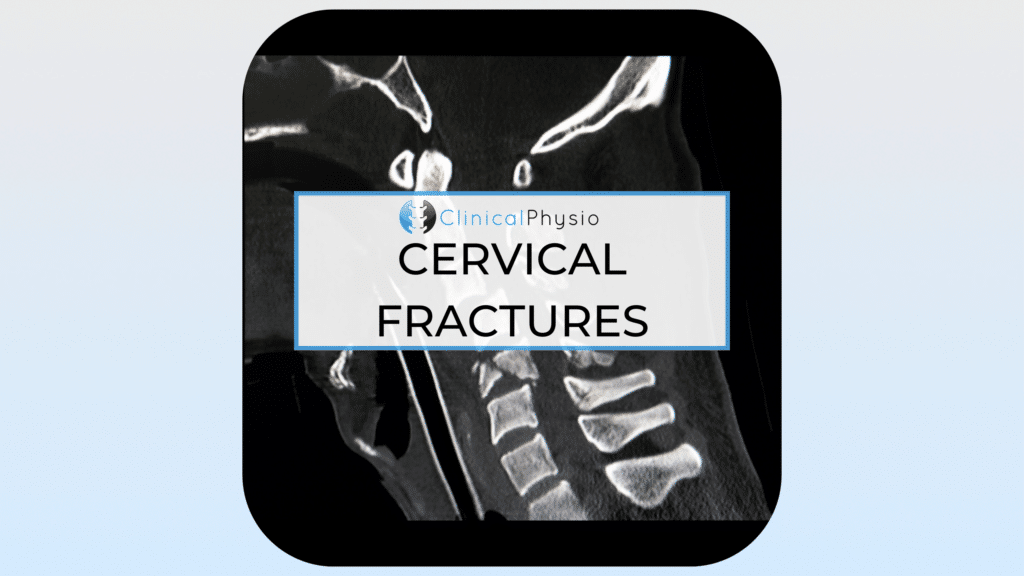 Cervical Fractures – Clinical Physio Membership