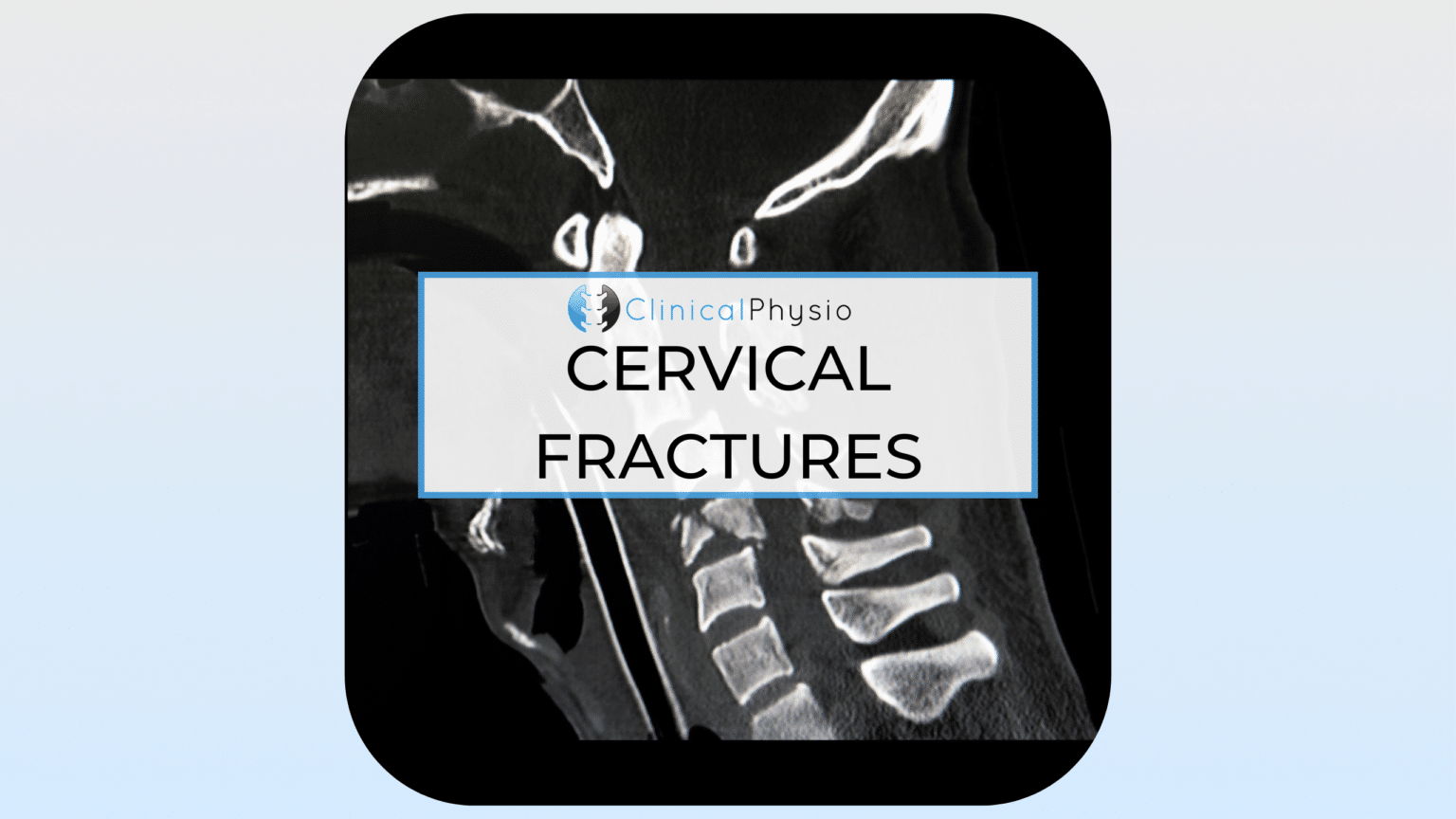 Cervical Fractures – Clinical Physio Membership