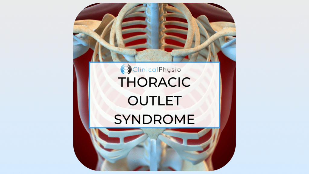 Thoracic Outlet Syndrome – Clinical Physio Membership