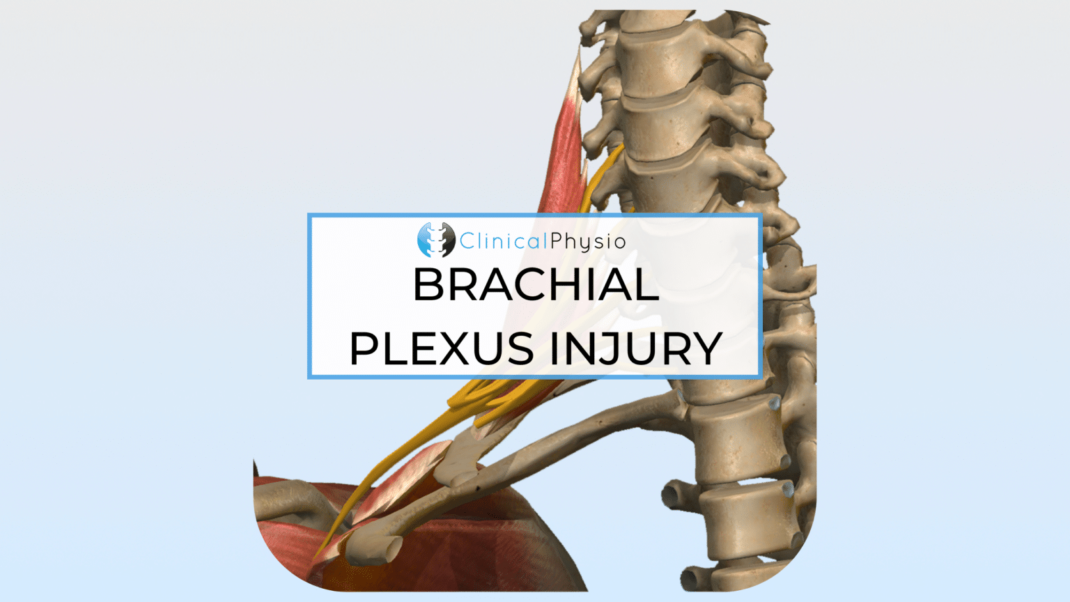Brachial Plexus Injuries – Clinical Physio Membership