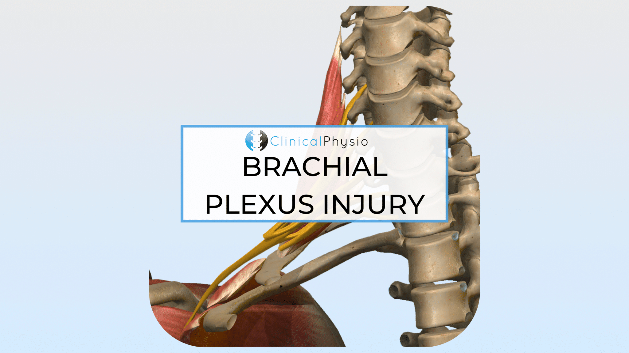Brachial Plexus Injuries – Clinical Physio Membership
