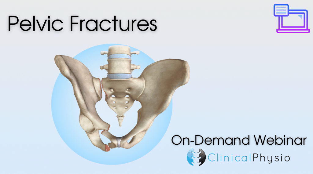 Pelvic Fractures – Clinical Physio Membership