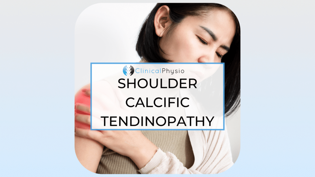 Shoulder Calcific Tendinopathy – Clinical Physio Membership
