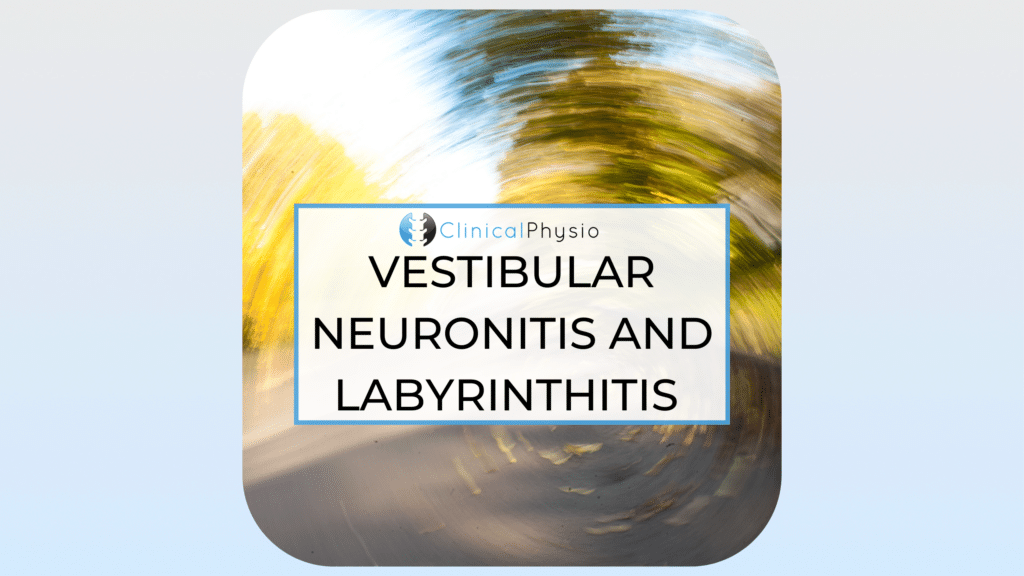 Vestibular Neuronitis and Labyrinthitis – Clinical Physio Membership