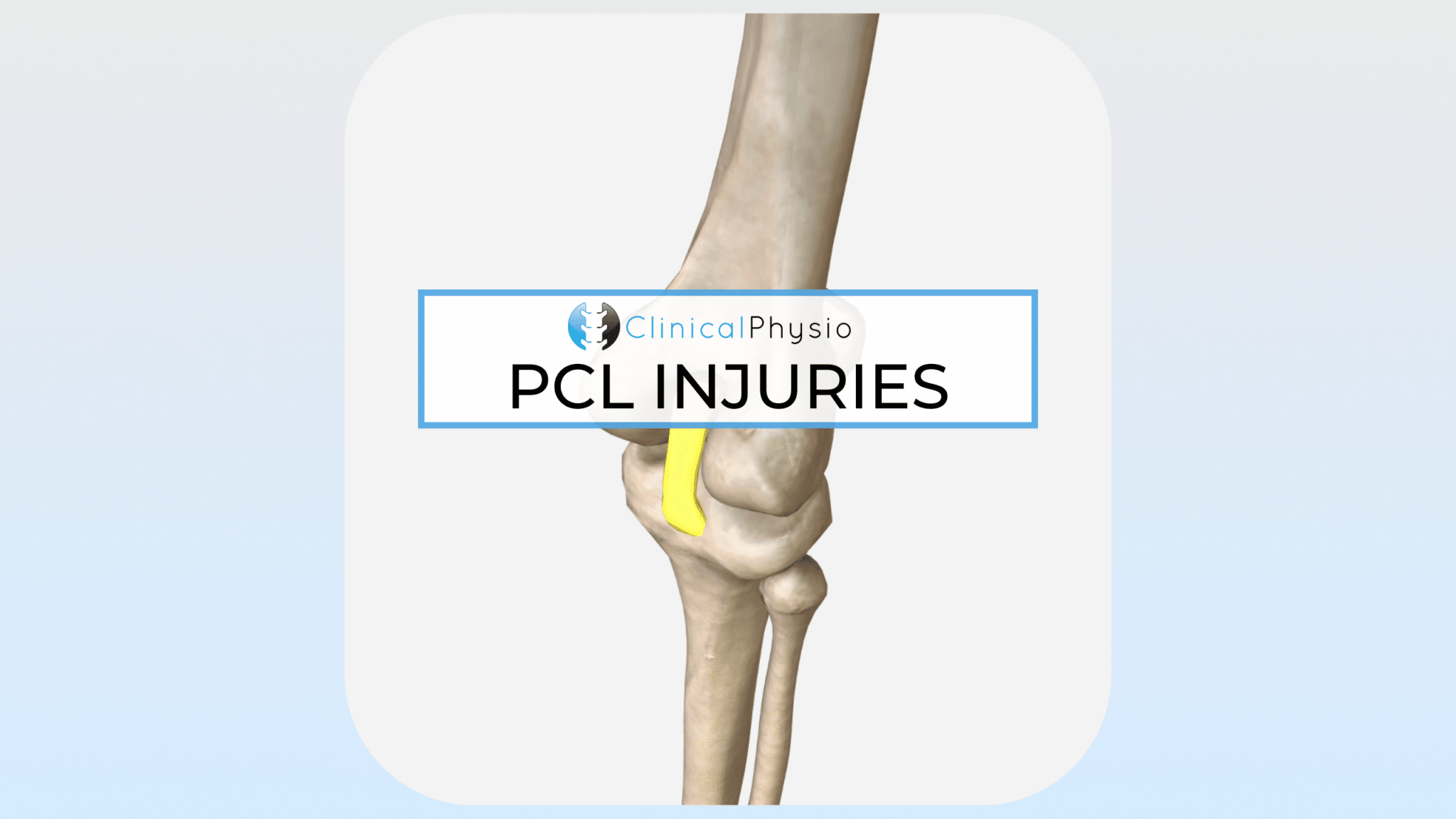 Posterior Cruciate Ligament Injuries – Clinical Physio Membership