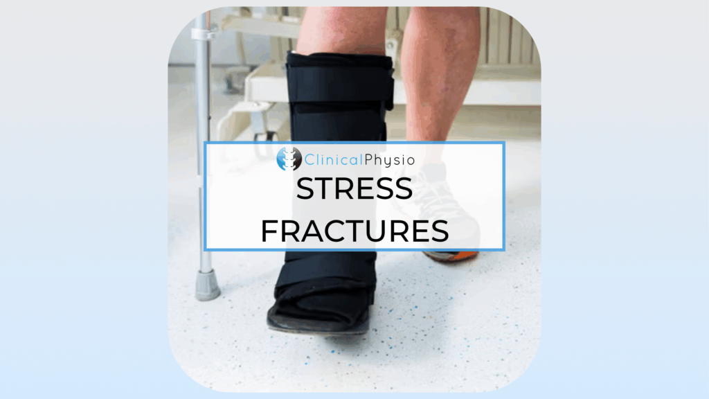 Stress Fractures – Clinical Physio Membership